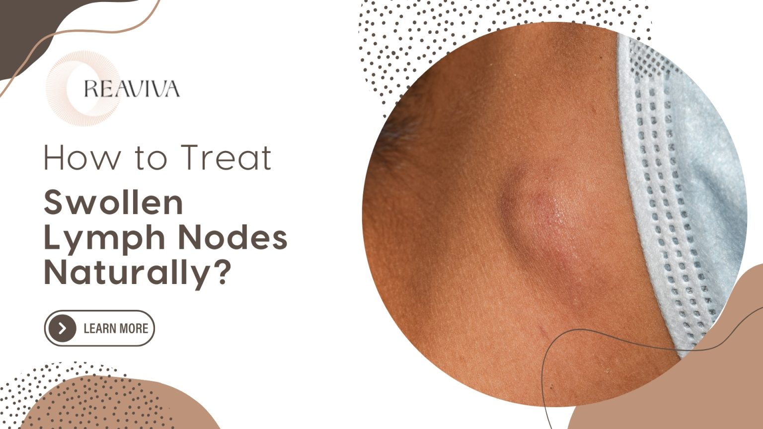 How to Treat Swollen Lymph Nodes Naturally? - Reaviva Holistic Health